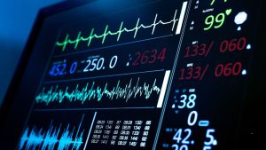 ECG Reading Normal And Abnormal