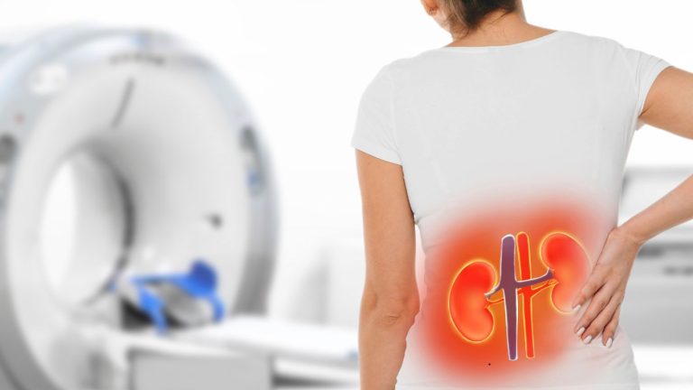 Female Kidney Pain Location On Back: Causes, Treatment